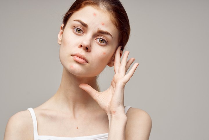 Eczema On Face: Identifying Causes And Treatment Options – Bare Skin ...